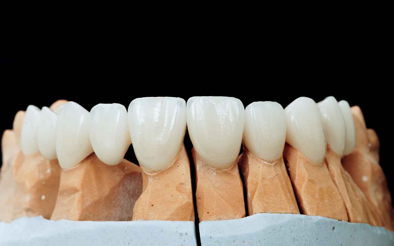Zirconium Crowns in Turkey, Istanbul 2023 - Now Aesthetic