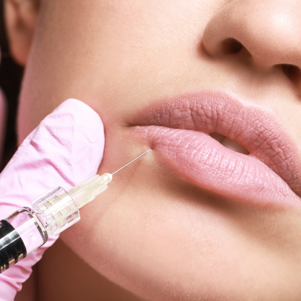 Nose Filler in Istanbul, Turkey - Now Aesthetic